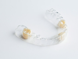 Essix Partial Denture Retainer Cost, Pros and Cons